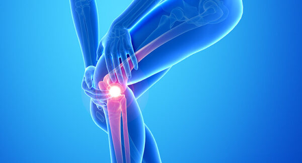 ¿Qué es una luxación y cómo se debe tratar? - Foot and Body